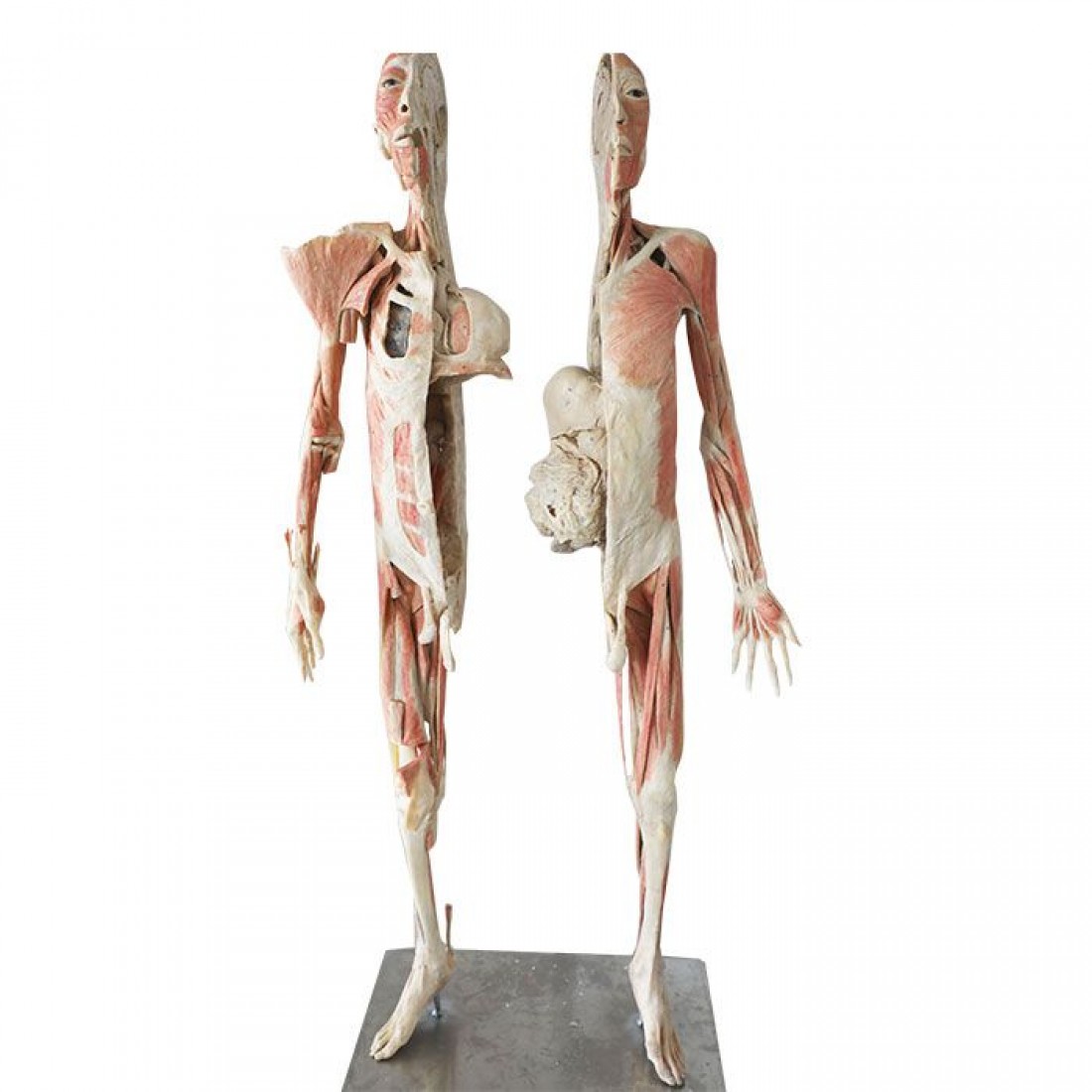 Human Plastinated Body