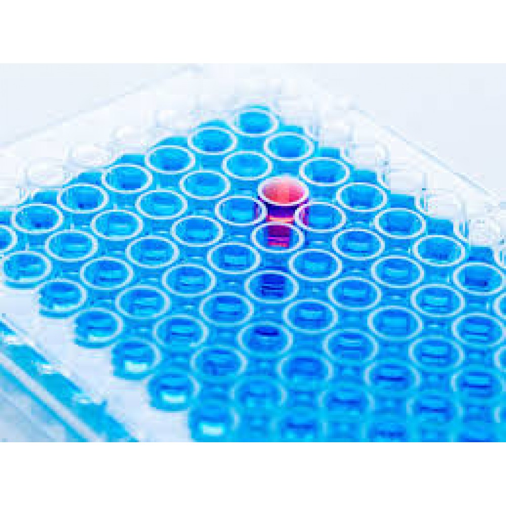 FSH, 100Wells,Reagent | ArkanLabs