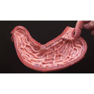Actual Human Stomach