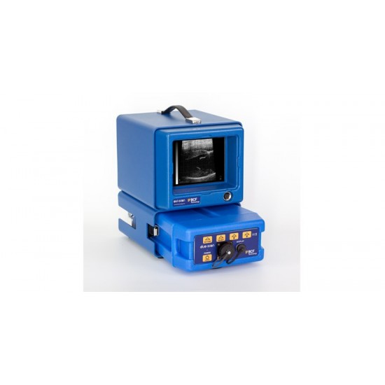 Portable ultrasound with unique 170° sector image for scanning foetal ...